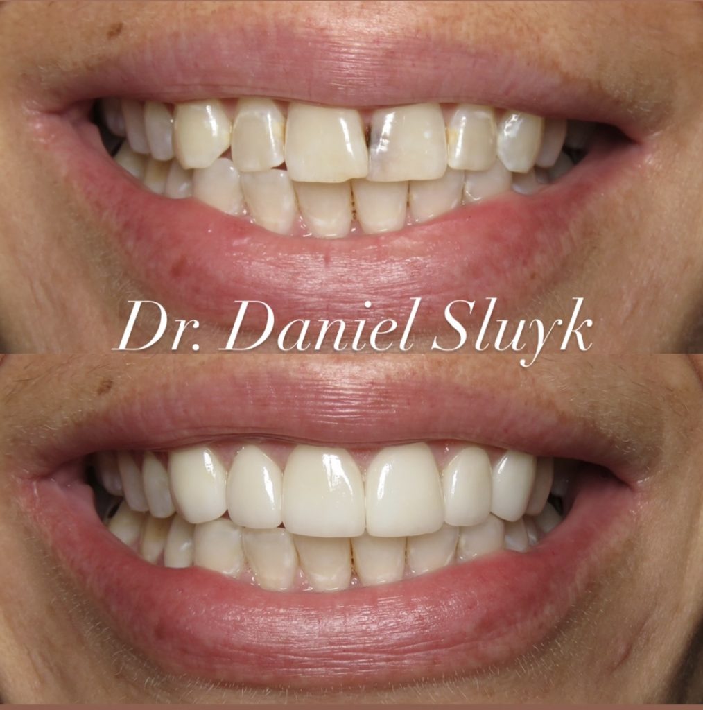 Smile Gallery | Daniel C Sluyk, DDS