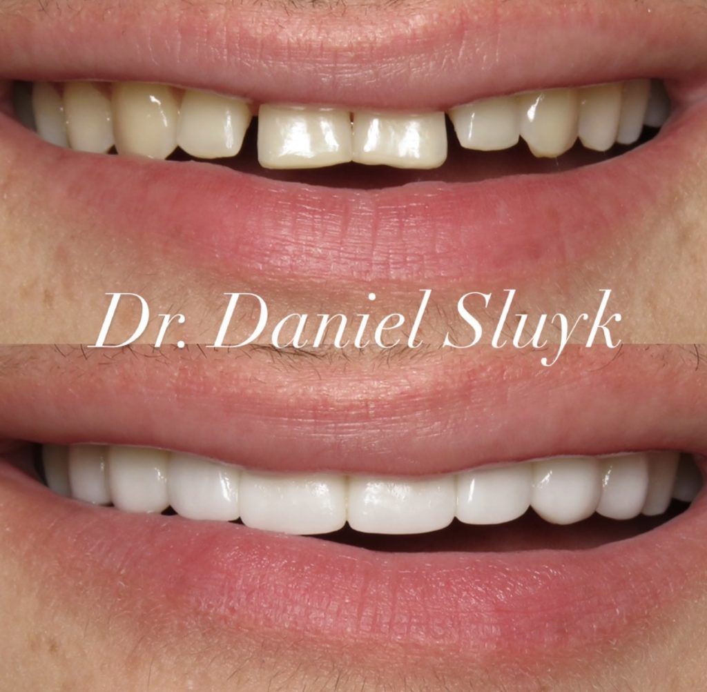 Smile Gallery | Daniel C Sluyk, DDS