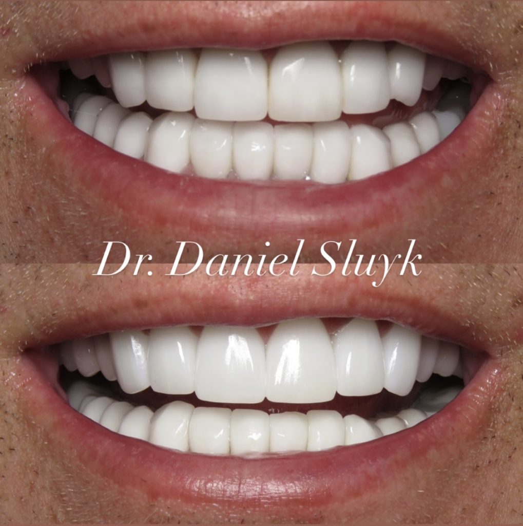 Smile Gallery | Daniel C Sluyk, DDS